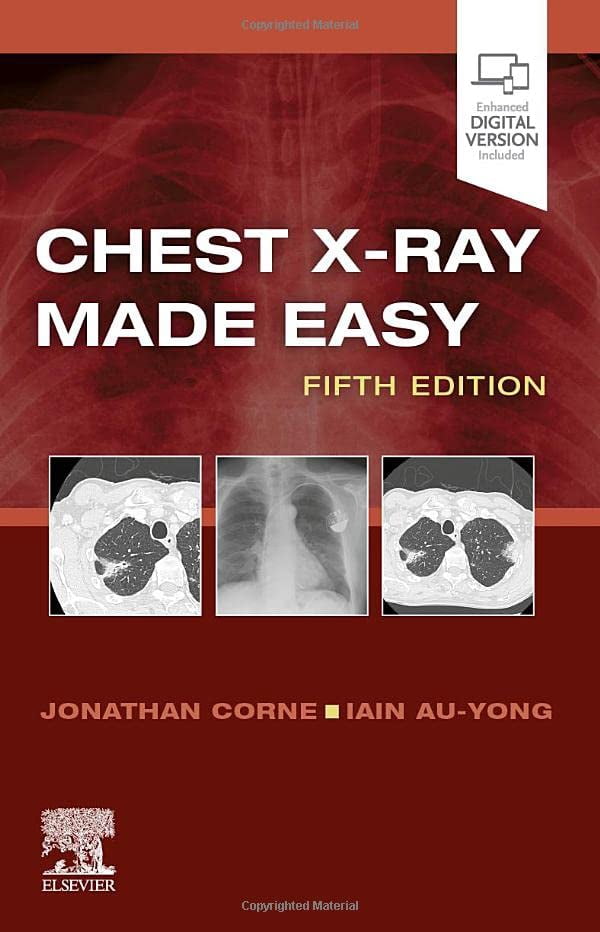 Pre-Owned Chest X-Ray Made Easy [Paperback] Corne MA PhD MB BS FRCP ...