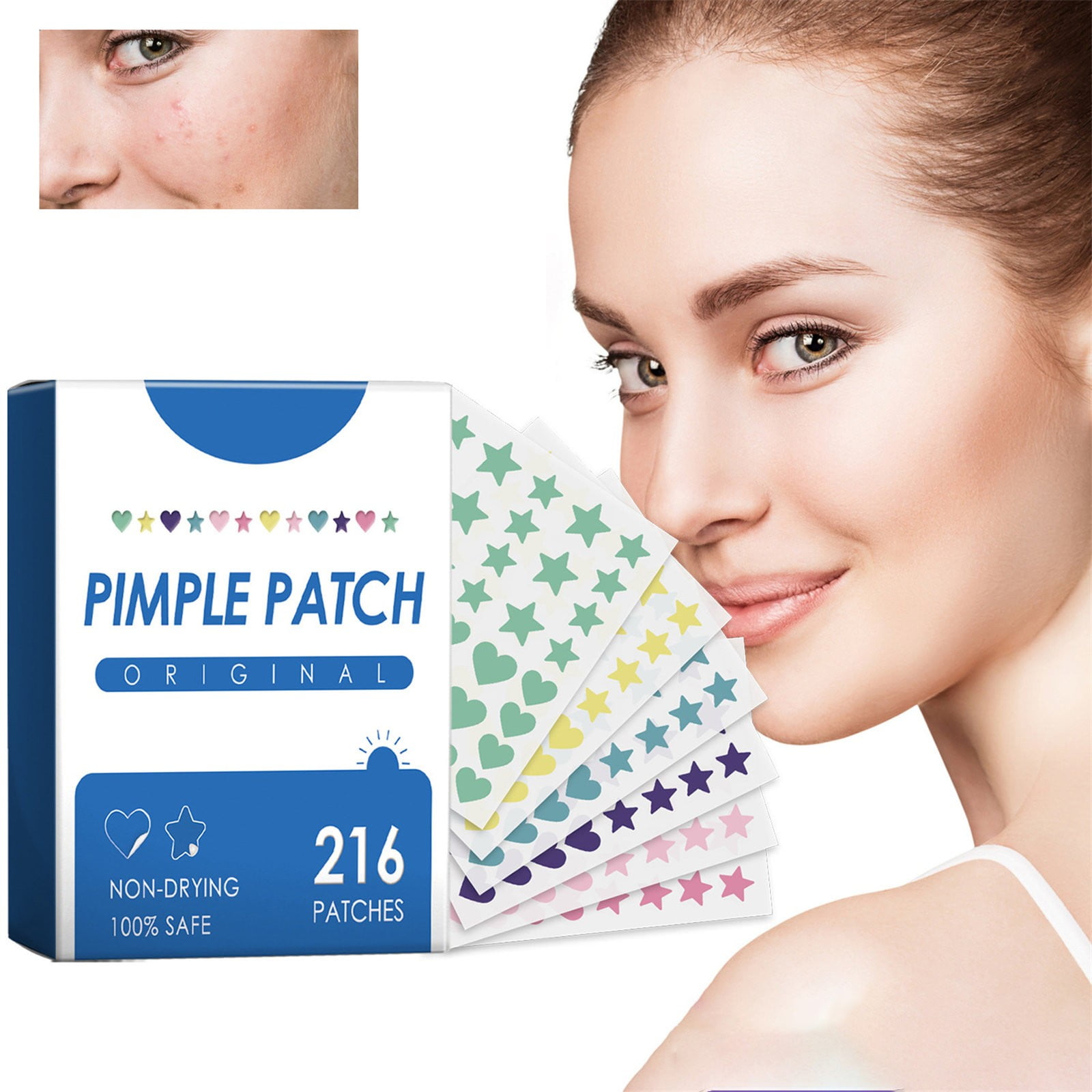 Chexio Clearance Pox Patch & Nose patch Pimple for Face 216 Pack ...