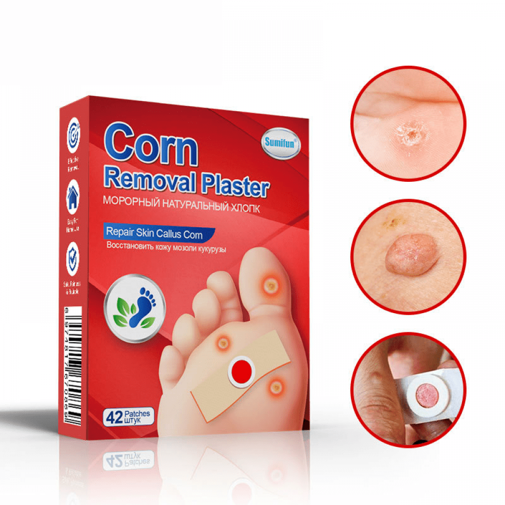 Chicken Eye Patch Chicken Eye Cream Foot Ting Metatarsal Warts Foot ...
