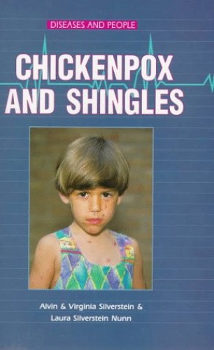 Pre-Owned Chicken Pox and Shingles Diseases People Library Binding ...