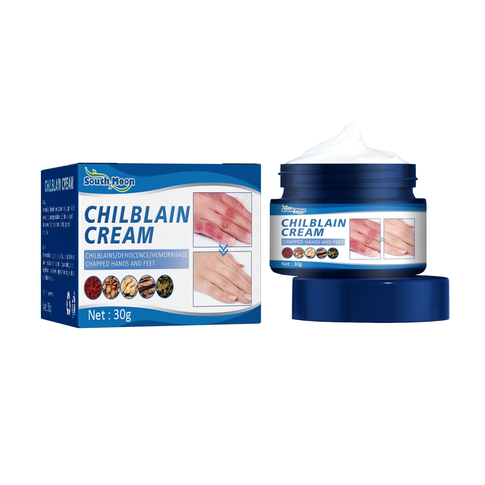 Antifreeze Dry Hands and Feet Crack Peeling Heel Crack Crack Crack Skin ...