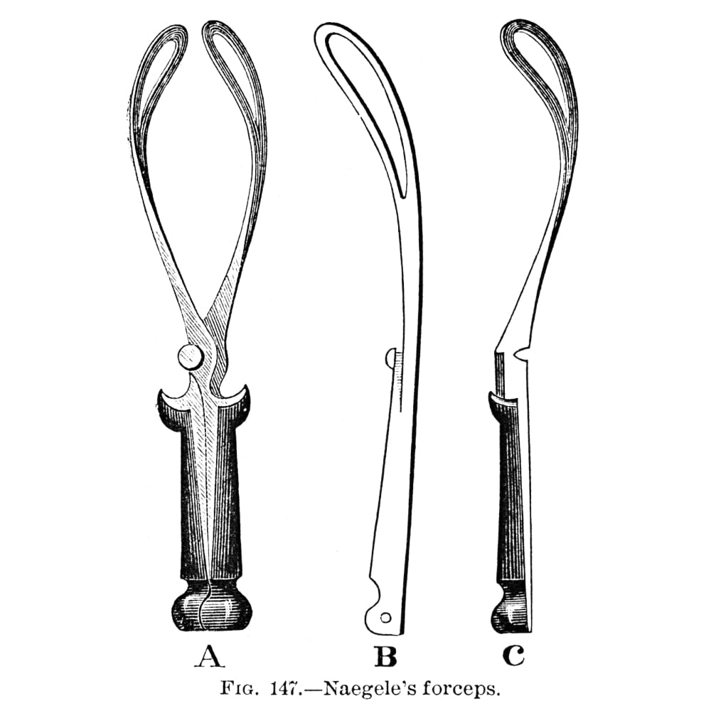 Childbirth Forceps C1880. Na Diagram Of Naegele'S Forceps Used In ...
