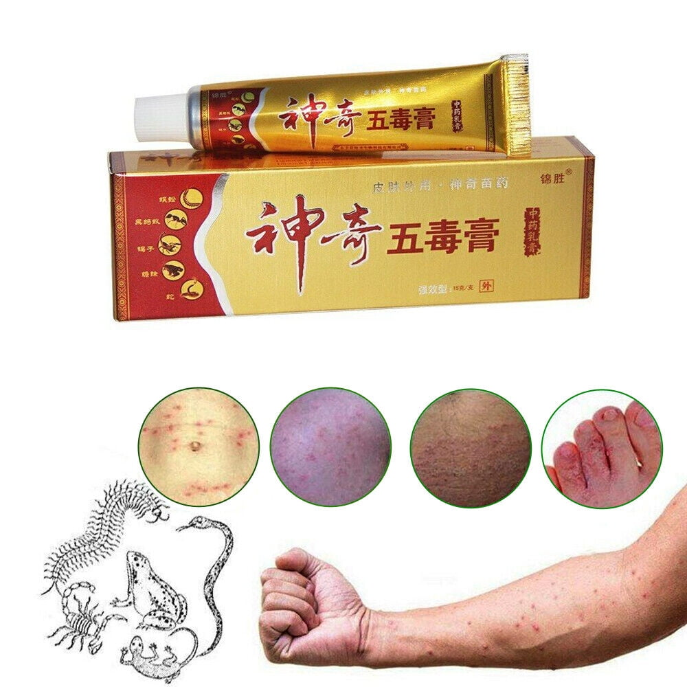 Chinese Burn Cream