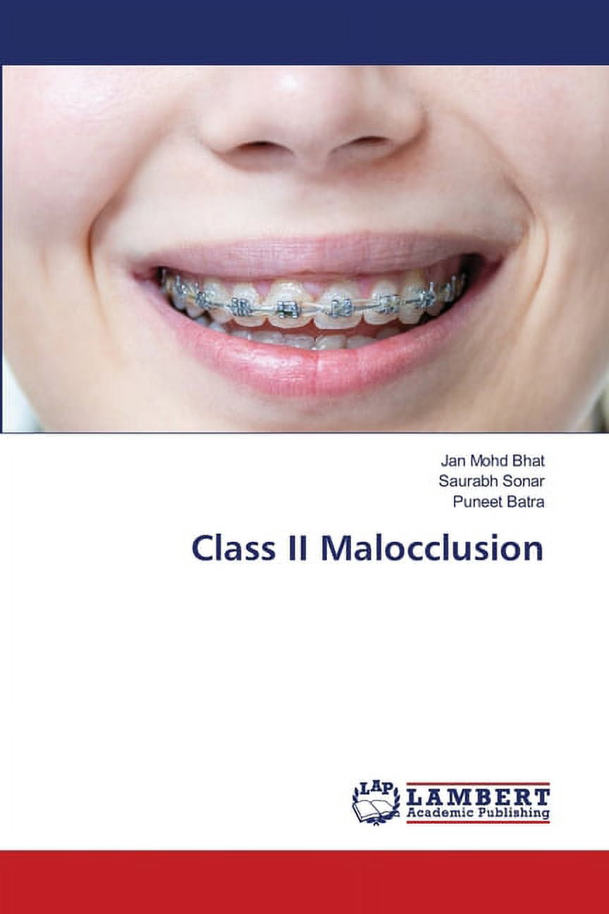 Class Ii Malocclusion