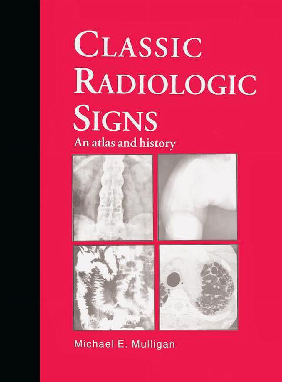 Classic Radiologic Signs: An Atlas and History, (Hardcover) - Walmart.com