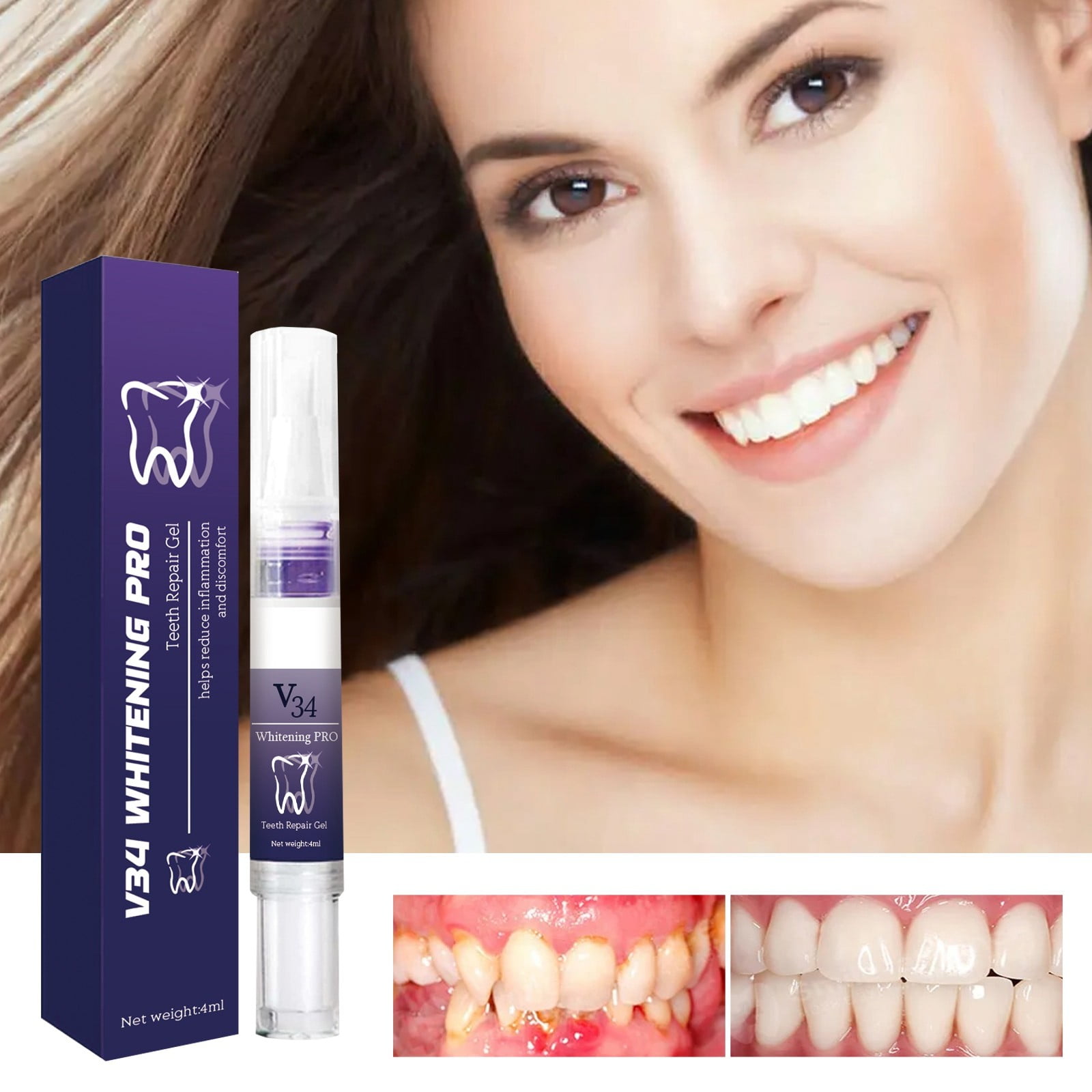 Cleaning Oral Odor Gel For Tooth And Oral Care Improve Health And ...