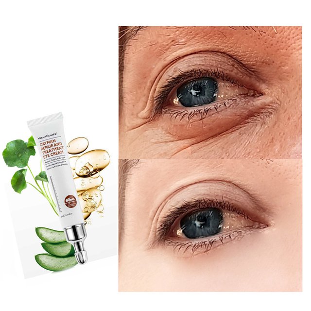 Clearance Under $5.00: Magic Eye Cream, Instantly Remove Under Eye Bags ...