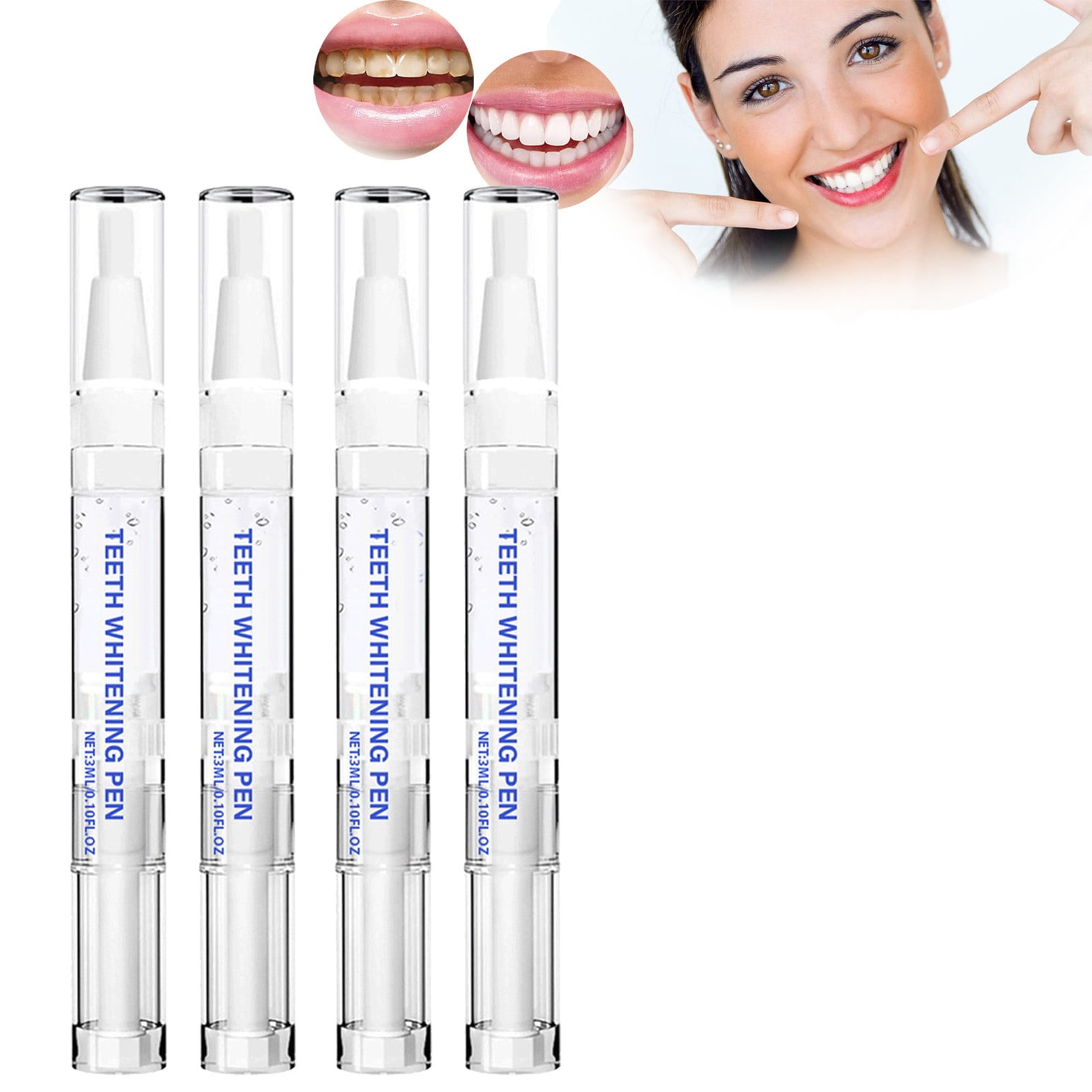 Clearance!DHALL Tooth care Teeth Pen (4 Count) No Sensitivity Teeth Gel ...