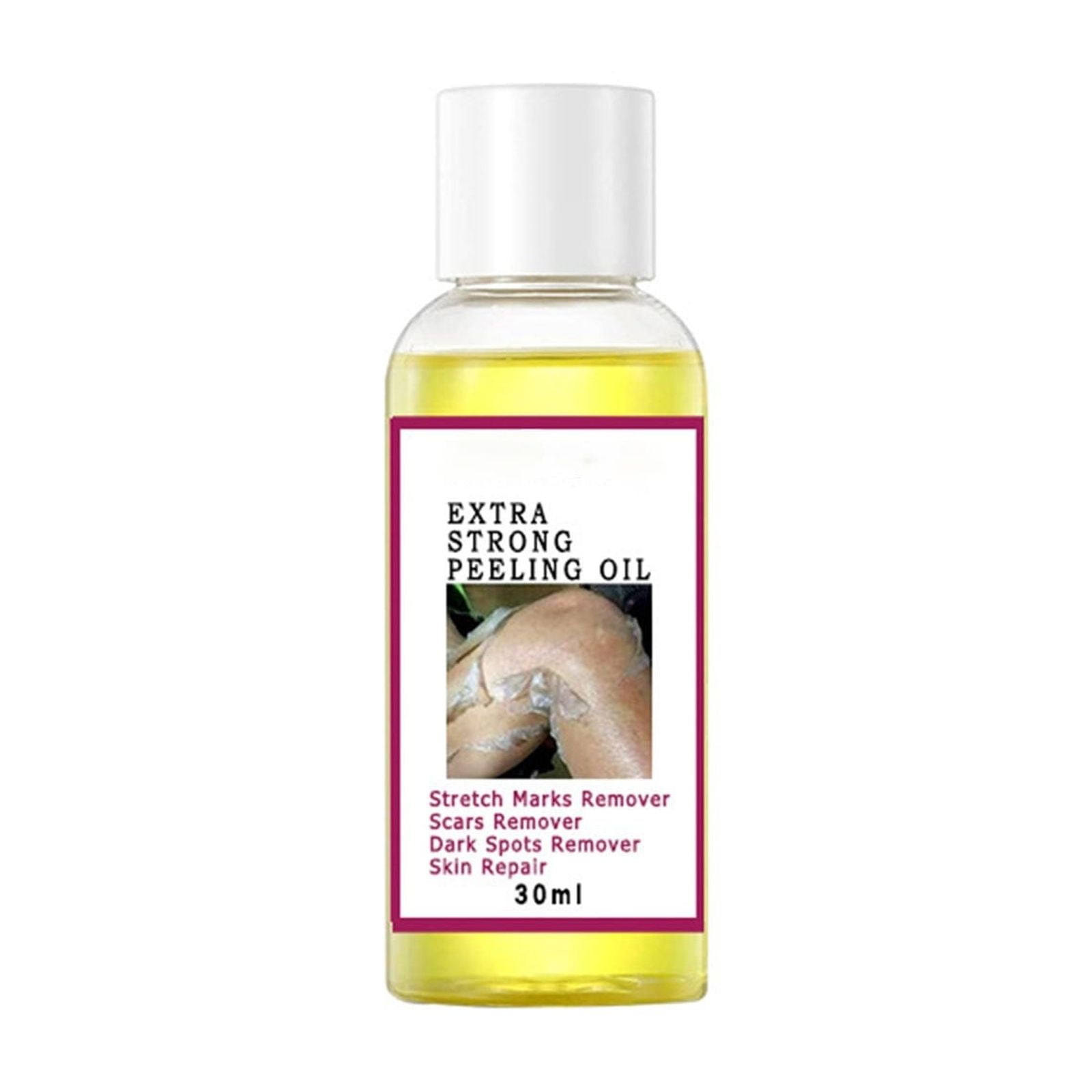 Clearance Exfoliating Peeling Oil For All Type Exfoliant For Glowing ...