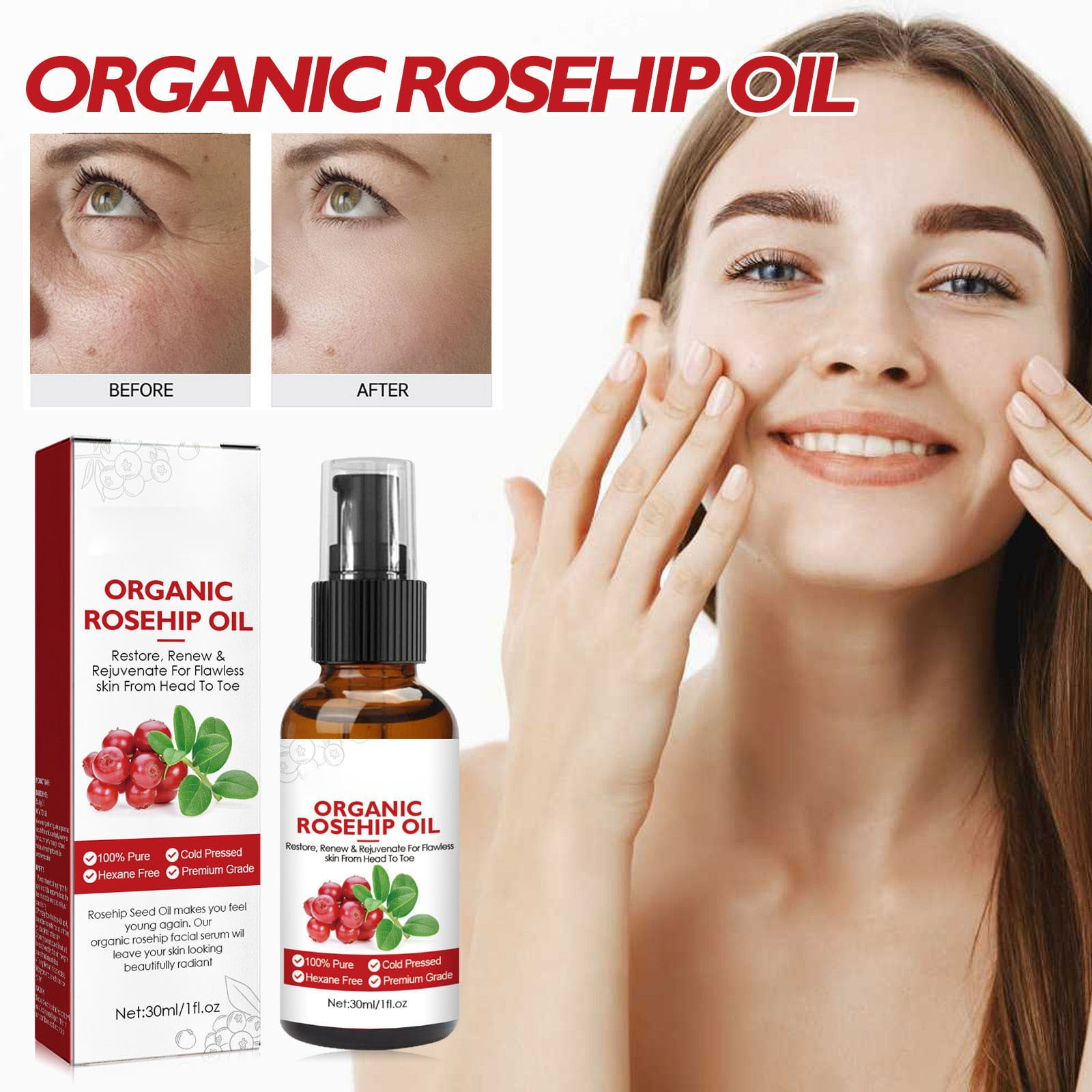 Clearance Items! Rose Hip Seed Oil Repair Skin Care Facial Moisturizing And Rejuvenating 30ml ...