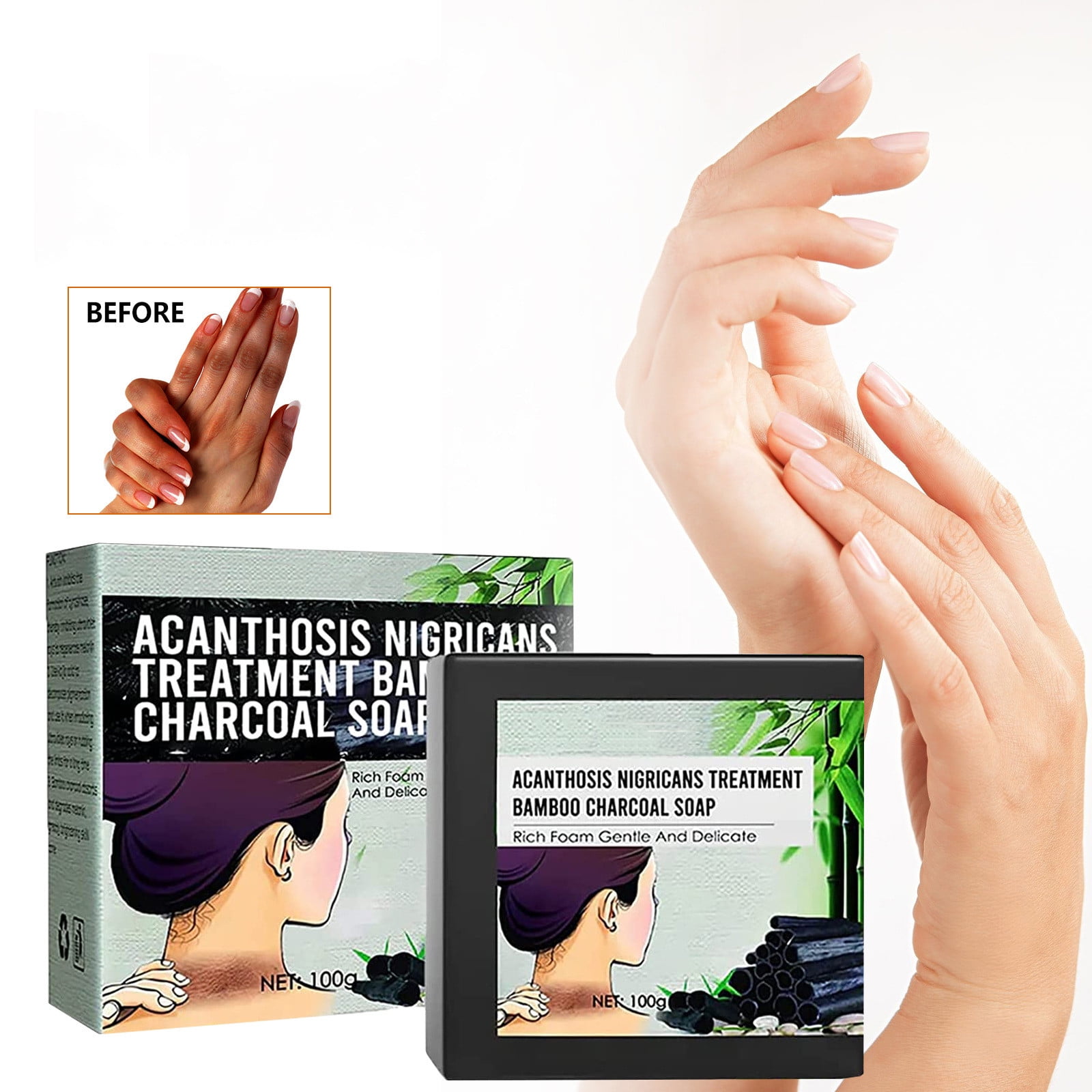 Clearance Sale! WEANT 100g Restorative Basho Soap Acanthosis Nigricans ...