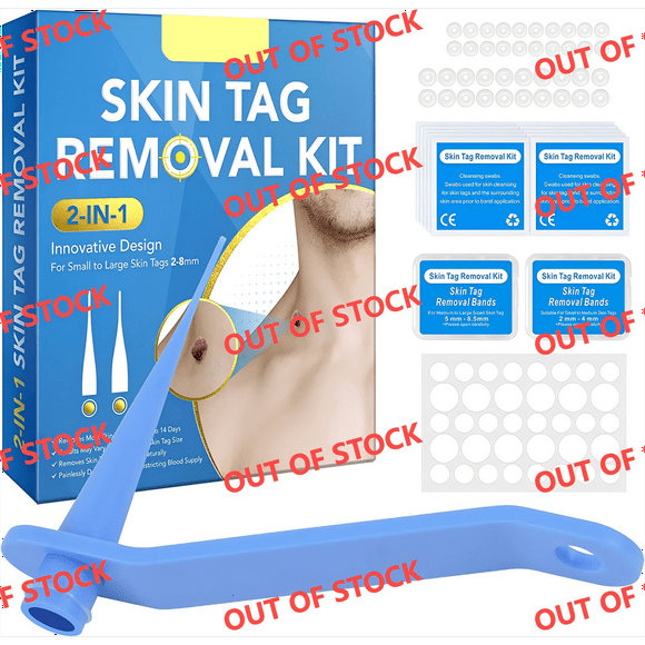 Skin Tag Removal Bands