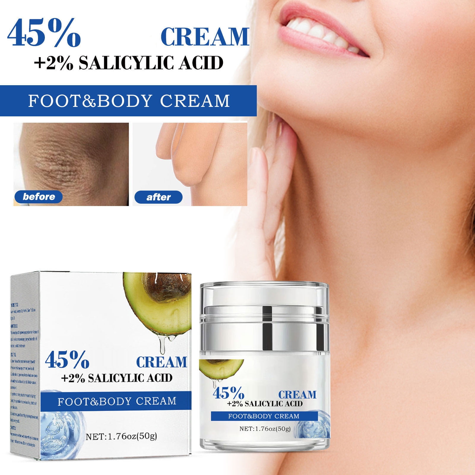 Clearance Skin Hands And Feet Antifreeze Dryness Cracking Peeling ...