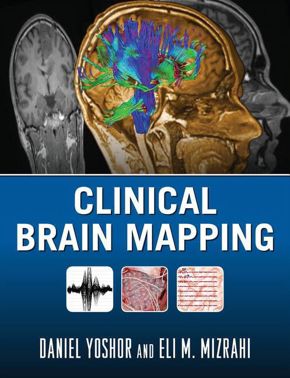 Clinical Brain Mapping (Hardcover) by Daniel Yoshor, Eli Mizrahi ...