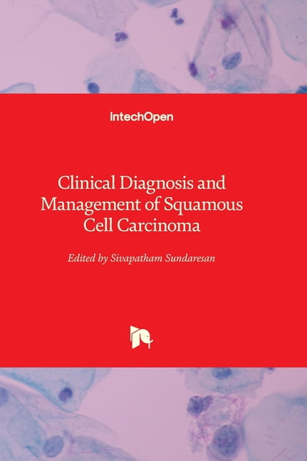 Clinical Diagnosis and Management of Squamous Cell Carcinoma, (Hardcover) - Walmart.com