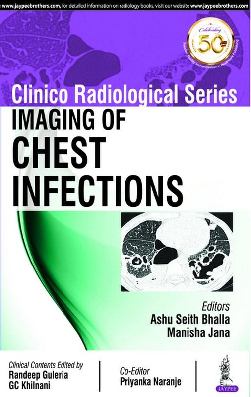 Clinico Radiological Series: Imaging of Chest Infections (Paperback) by ...