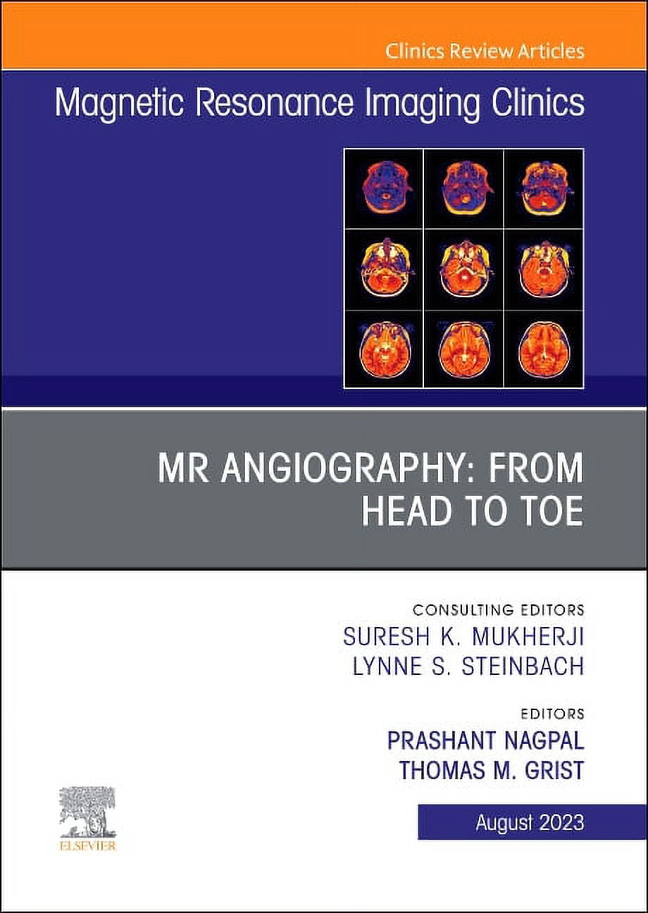 Clinics: Radiology MR Angiography: From Head to Toe, an Issue of ...