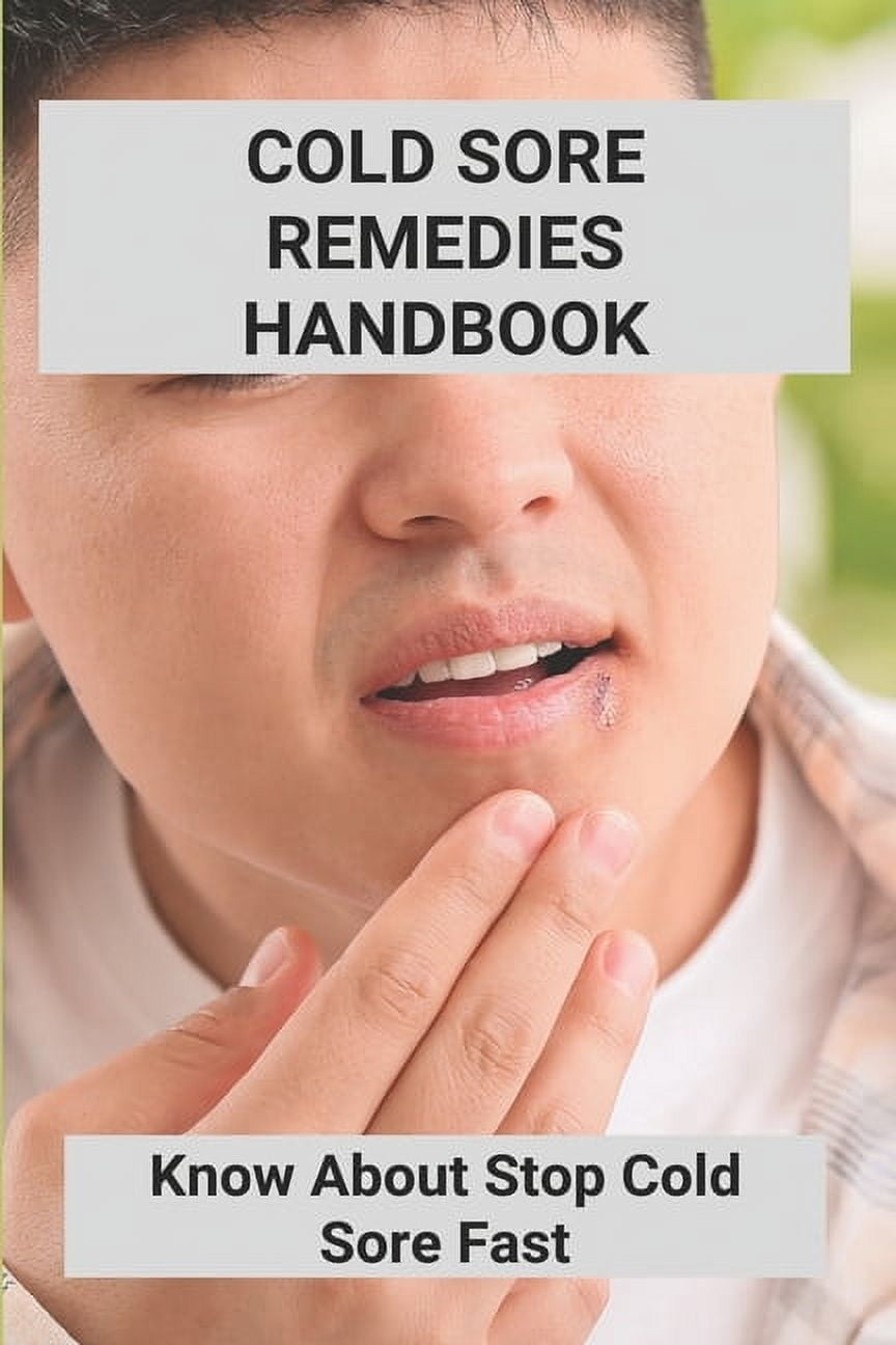 Cold Sore Remedies Handbook: Know About Stop Cold Sore Fast: Veatu Fast ...