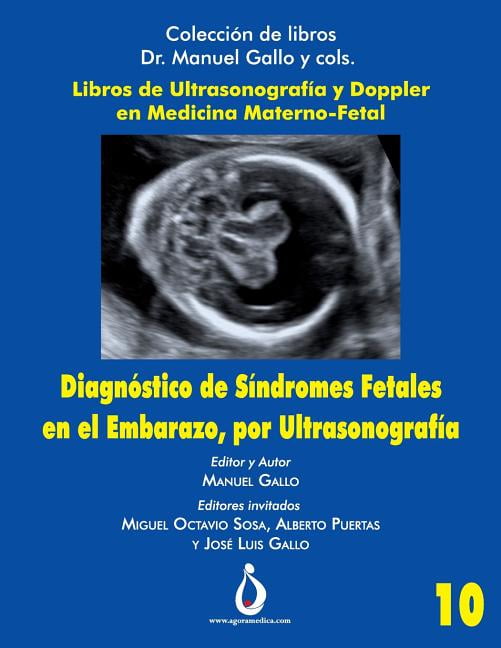 Colección de Libros Dr. Manuel Gallo Y Cols: Diagnostico de Síndromes ...