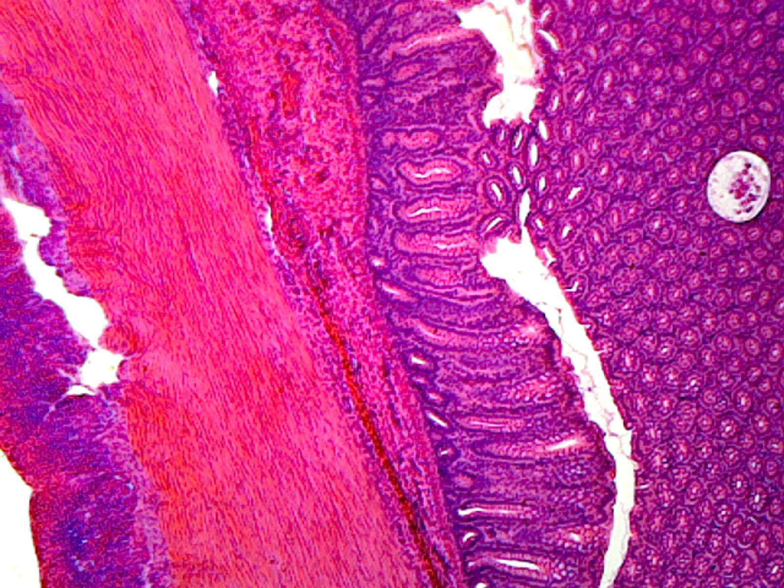 Colon, Human; Showing Typical Histology Structures; Cross Section by Go ...