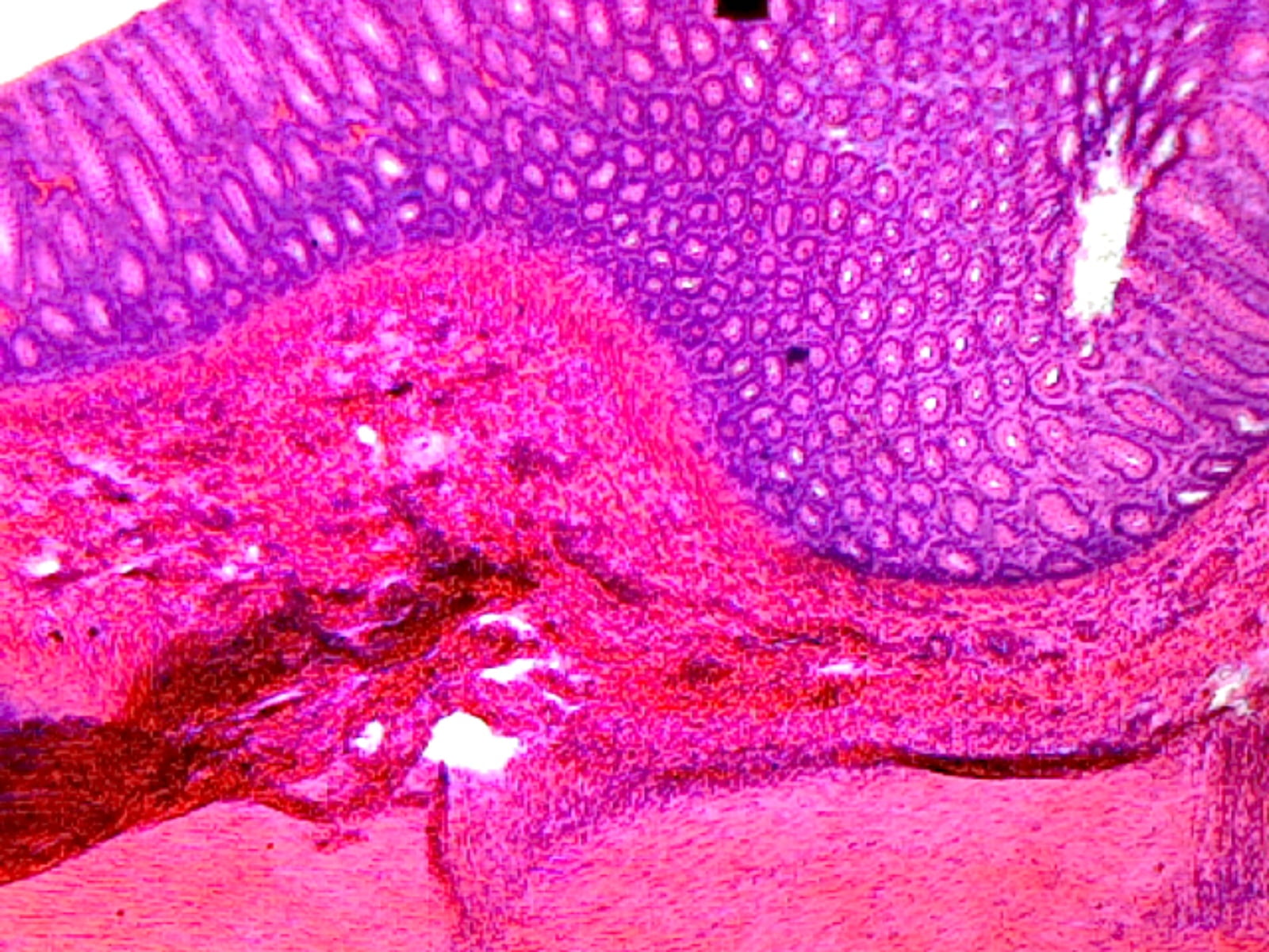 Colon, Mammalian; Showing Typical Histology Structures; Cross Section ...