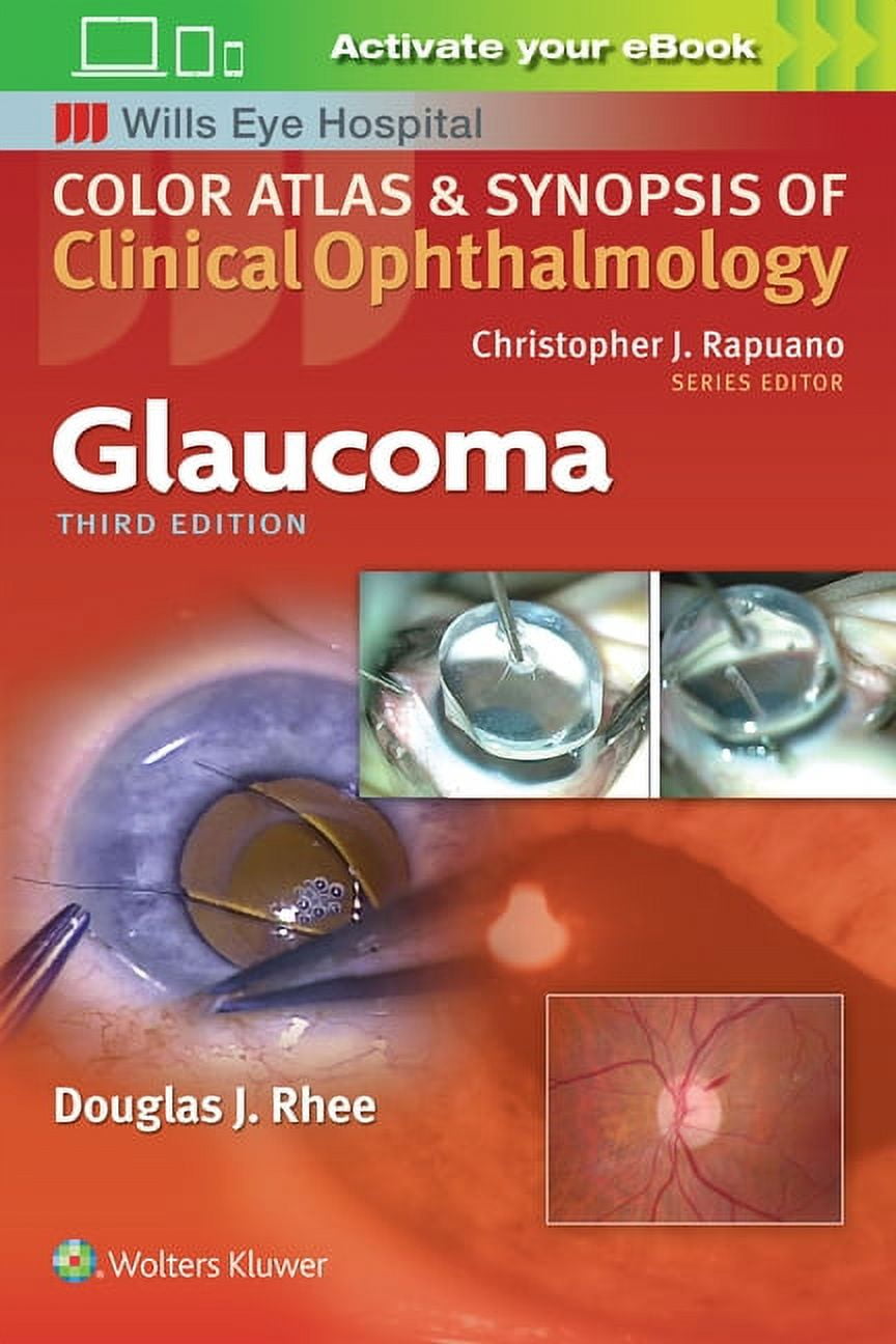 Color Atlas and Synopsis of Clinical Ophthalmology: Glaucoma (Edition 3 ...