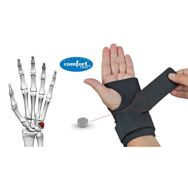 Comfort Cool Ulnar Booster Support Provides Compression for Ulnar Sided ...