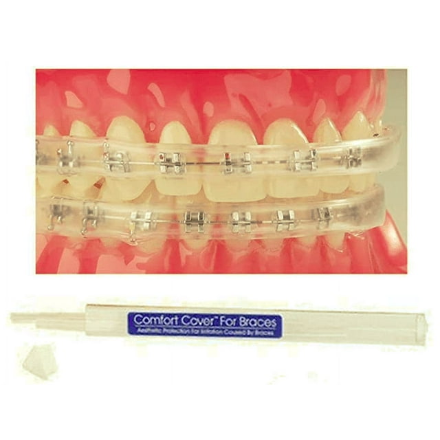 Comfort Lip Shield Teeth Protector - Top & Bottom Mouthpiece for Braces ...