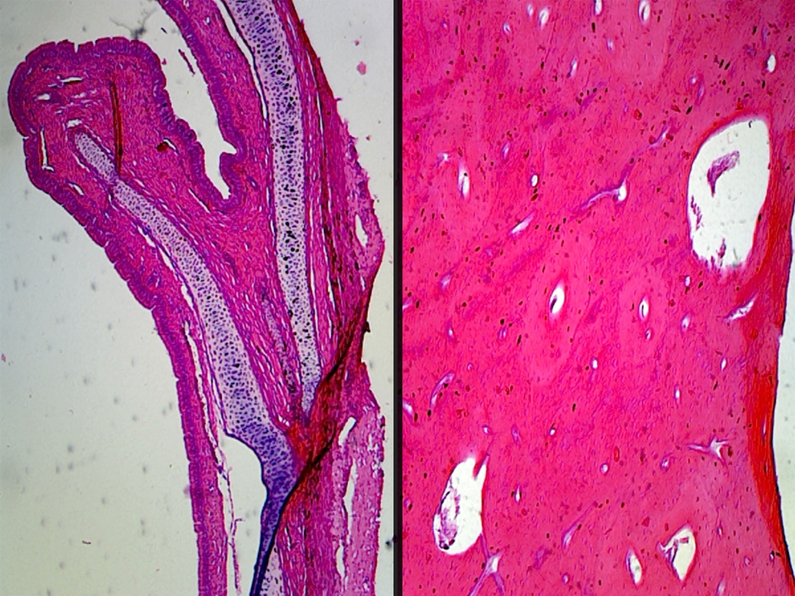 Compact Bone, Decalcified Preparation; Cross Section and Longitudinal ...