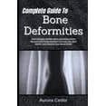 Complete Guide To Bone Deformities: Unlock Stronger, Healthier Bones ...