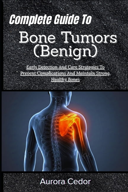 Complete Guide To Bone Tumors (Benign): Early Detection And Care ...