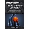 Complete Guide To Bone Tumors (Benign): Early Detection And Care ...