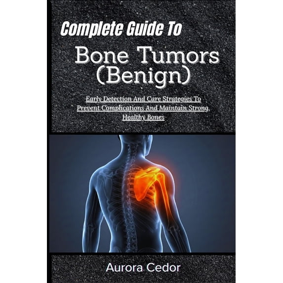 Complete Guide To Bone Tumors (Benign): Early Detection And Care ...