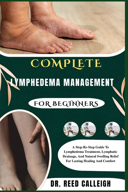 Complete Lymphedema Management for Beginners: A Step-By-Step Guide To ...