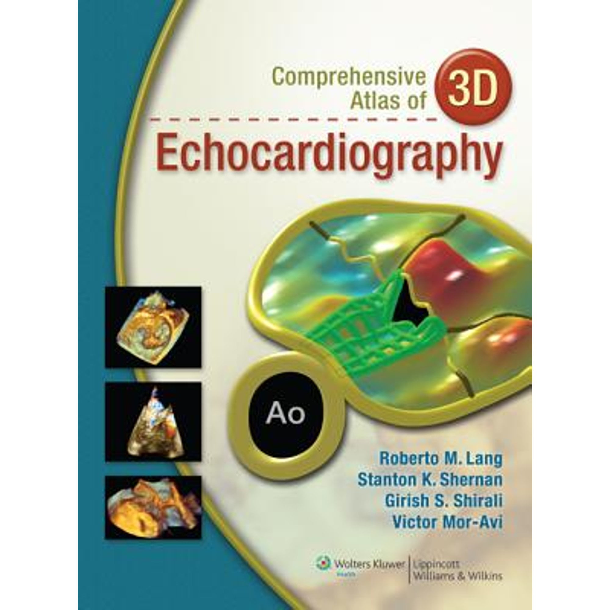 Comprehensive Atlas of 3D Echocardiography (Hardcover) by Stanton K ...