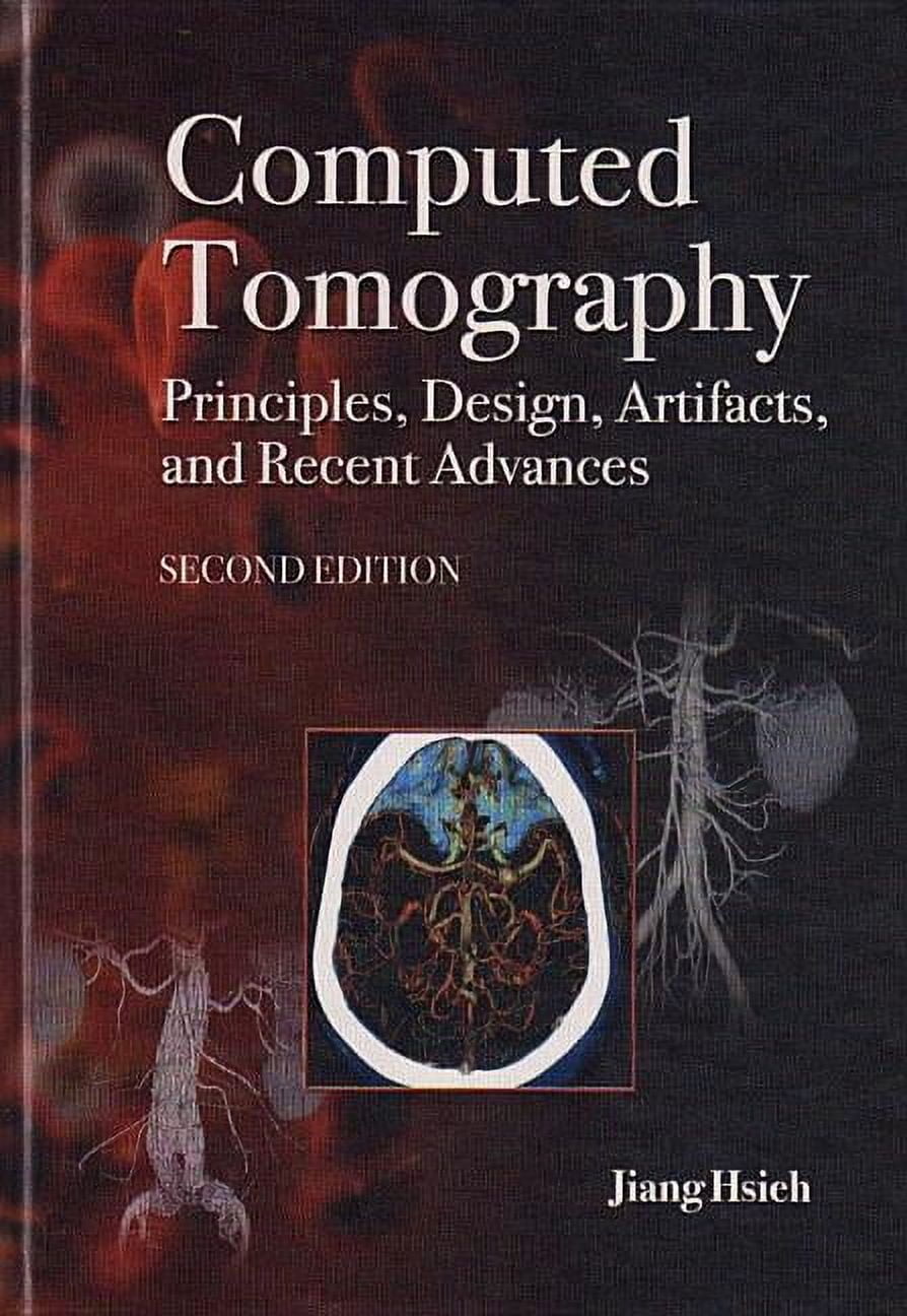 Computed Tomography Principles, Design, Artifacts, and Recent Advances ...