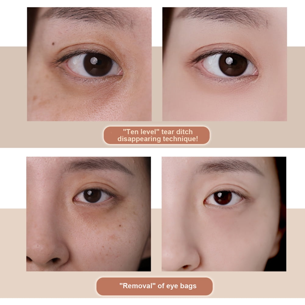 Concealer Plate Brightening Moisturizing Acne Cover Dark Circles Spots ...