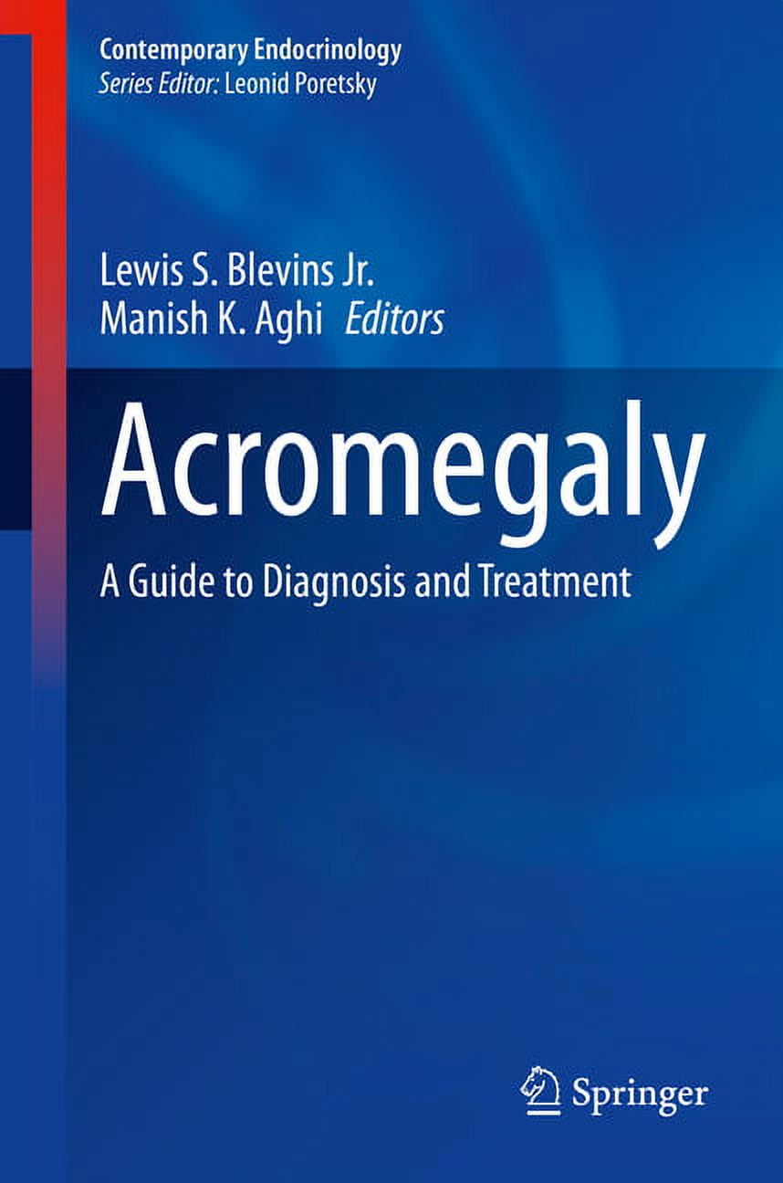 Contemporary Endocrinology Acromegaly: A Guide to Diagnosis and ...