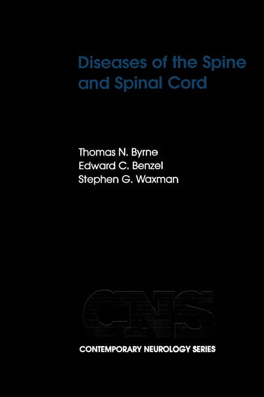 Contemporary Neurology Diseases of the Spine and Spinal Cord, Book 58 ...