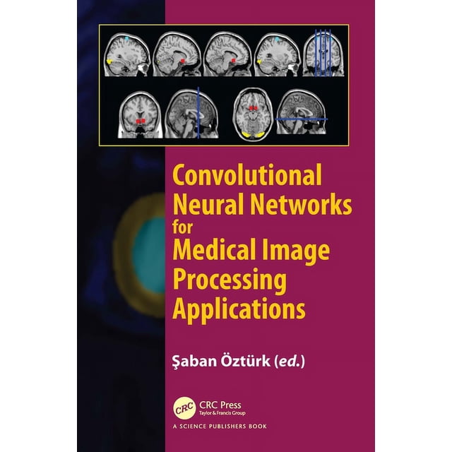 Convolutional Neural Networks for Medical Image Processing Applications ...