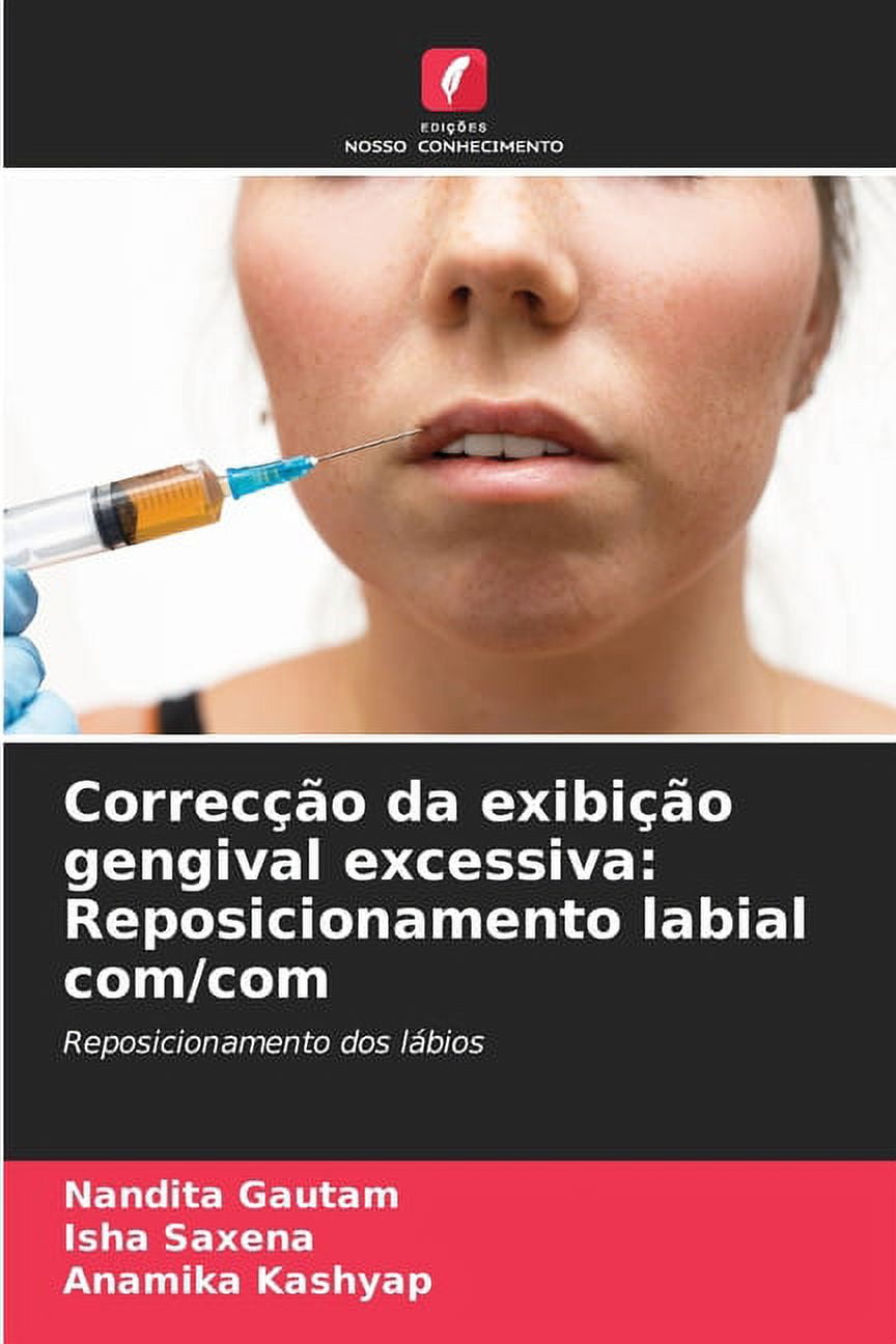 Correcção da exibição gengival excessiva: Reposicionamento labial com ...
