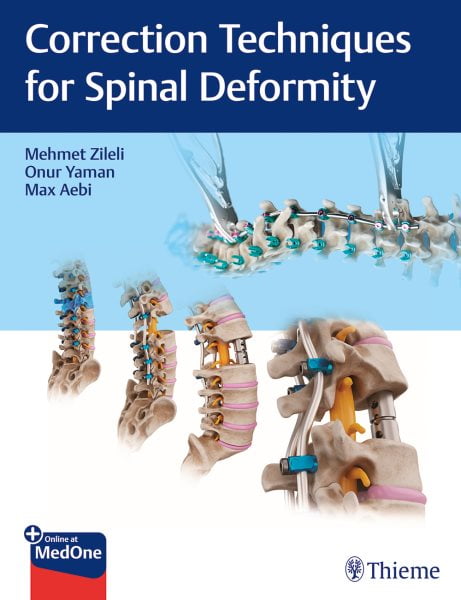 Pre-Owned Correction Techniques for Spinal Deformity (Hardcover ...