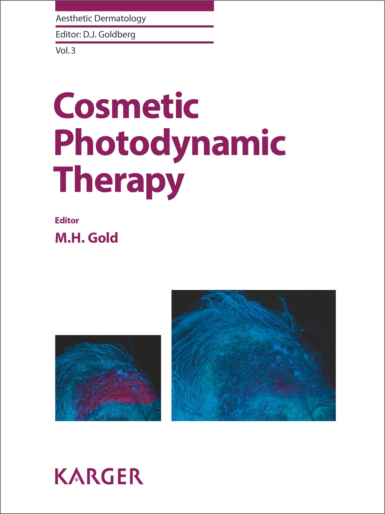 Gold Dermatology