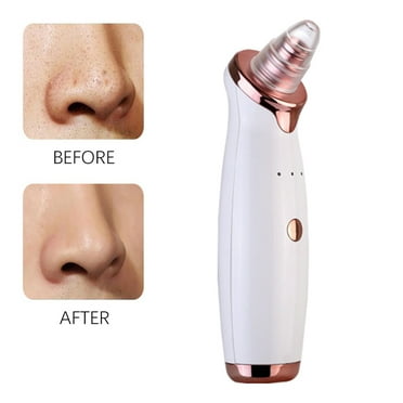 Blackhead Remover Pore Vacuum Pimple Extractor with Curved Acne Removal ...