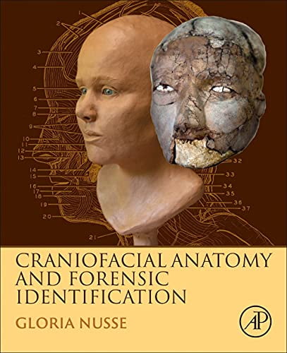 Pre-Owned Craniofacial Anatomy and Forensic Identification [Hardcover ...
