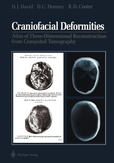 Craniofacial Deformities: Atlas of Three-Dimensional Reconstruction ...