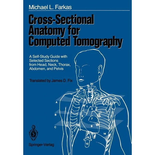 Cross-Sectional Anatomy for Computed Tomography: A Self-Study Guide ...