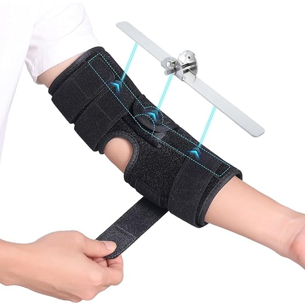 Cubital Tunnel Syndrome Elbow Brace, Ulnar Nerve Entrapment Splint ...
