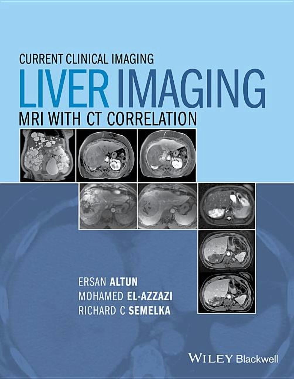Current Clinical Imaging Liver Imaging: MRI with CT Correlation, Book 1 ...