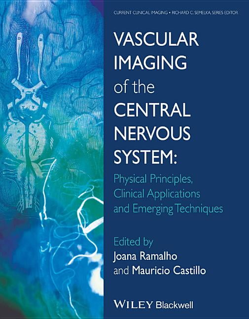 Current Clinical Imaging: Vascular Imaging of the Central Nervous ...